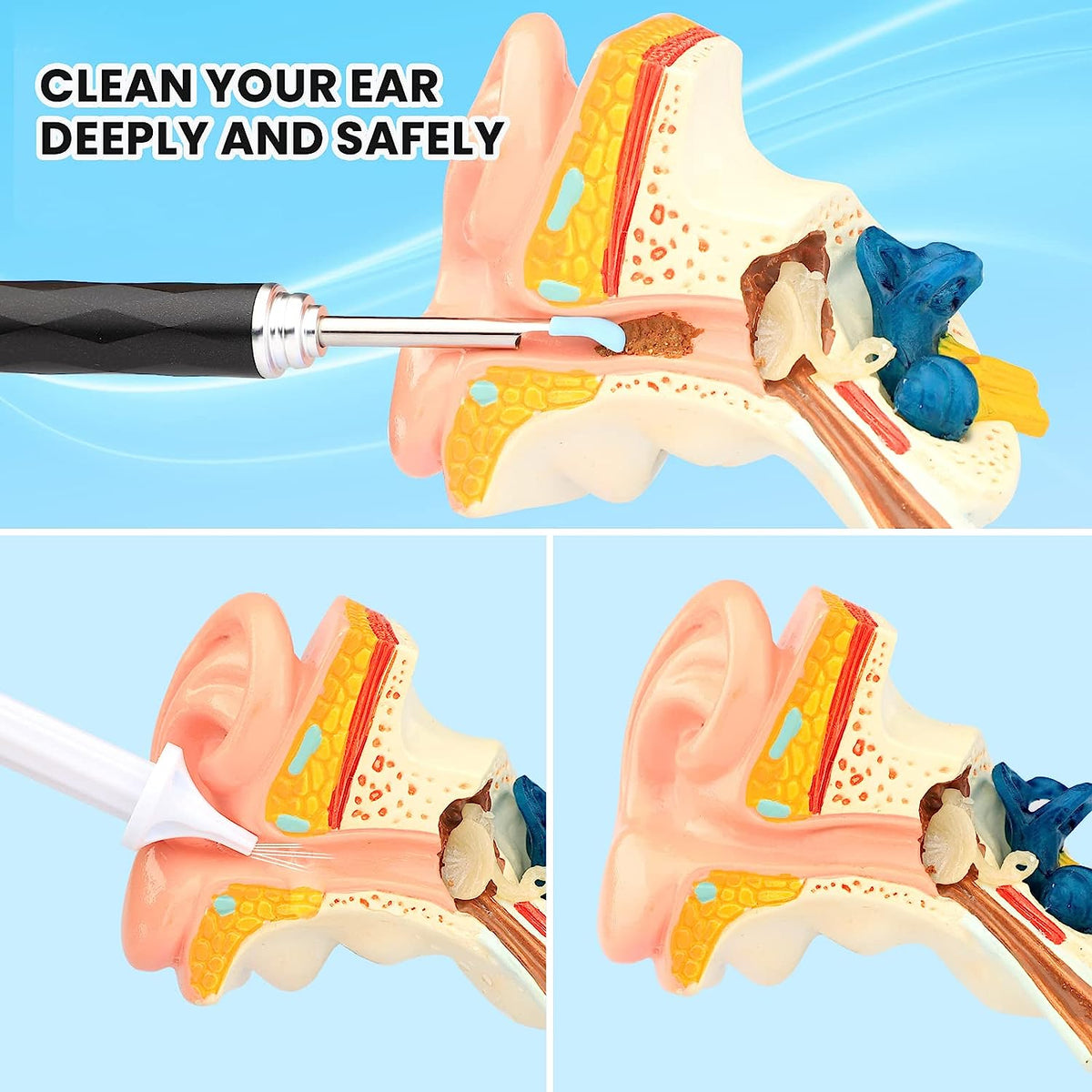 HD Visible Battery Powered Ear Wax Removal Kit, IP67 1080P Camera 6 LE ...